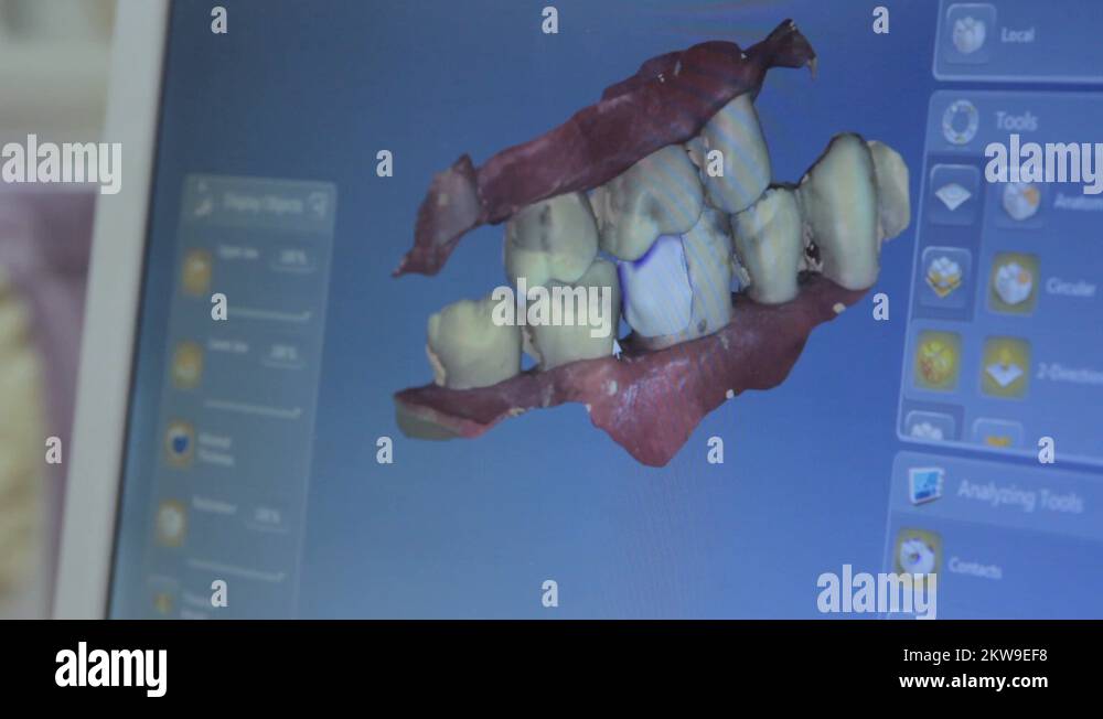 Oral health display Stock Videos & Footage - HD and 4K Video Clips - Alamy