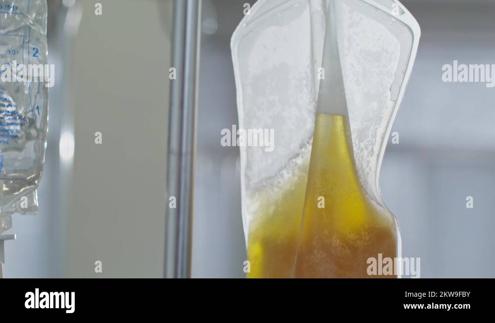 Young plasma transfusion Stock Videos & Footage - HD and 4K Video Clips ...