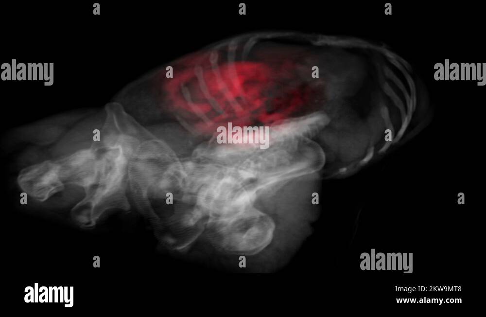 Highlighted body Stock Videos & Footage - HD and 4K Video Clips - Alamy