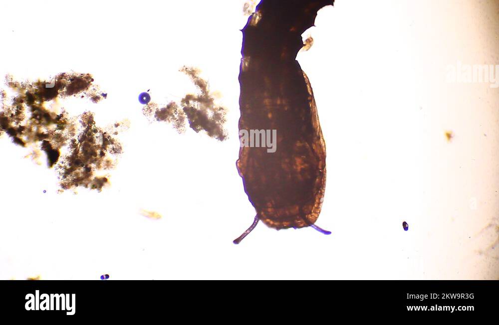 Microscopy - Rotifer Mniobia Magna on a microscopic larva Stock Video ...