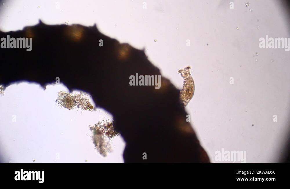 Microscopy - Rotifer Mniobia Magna on a microscopic larva Stock Video ...