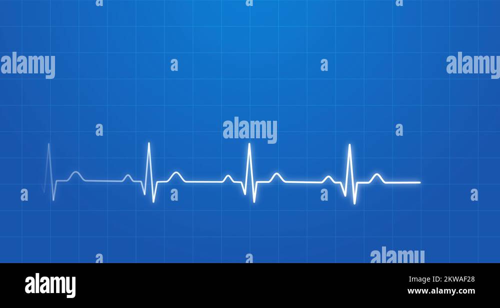Blueprint Of Normal Electrocardiogram Graphic 4K Animation Stock Video ...