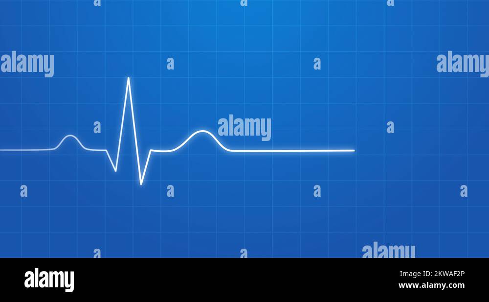 Normal electrocardiogram Stock Videos & Footage - HD and 4K Video Clips ...