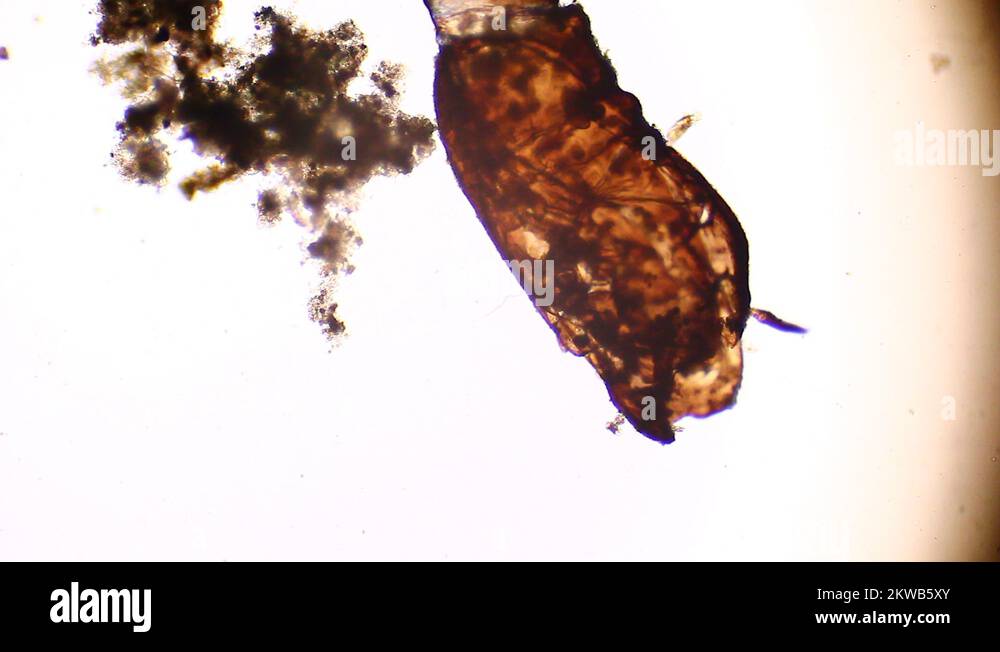 Microscopy - Rotifer Mniobia Magna on a microscopic larva Stock Video ...