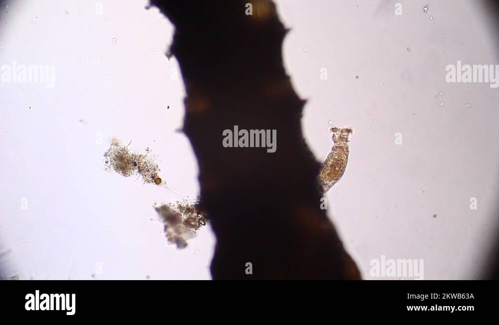 Microscopy - Rotifer Mniobia Magna on a microscopic larva Stock Video ...