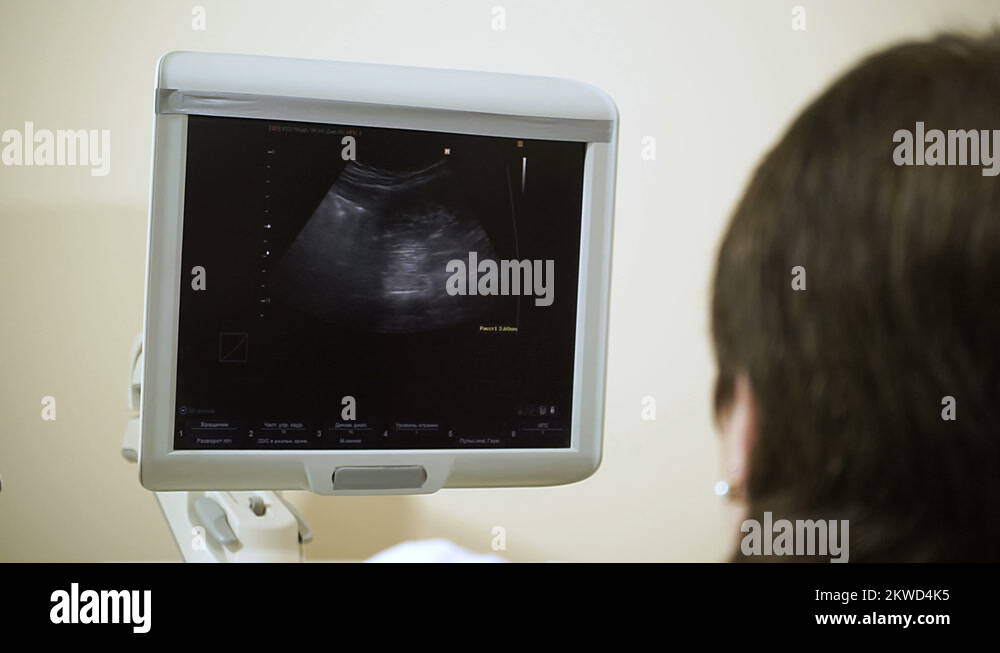 Female doctor examining the woman's kidneys using an ultrasound scanner ...