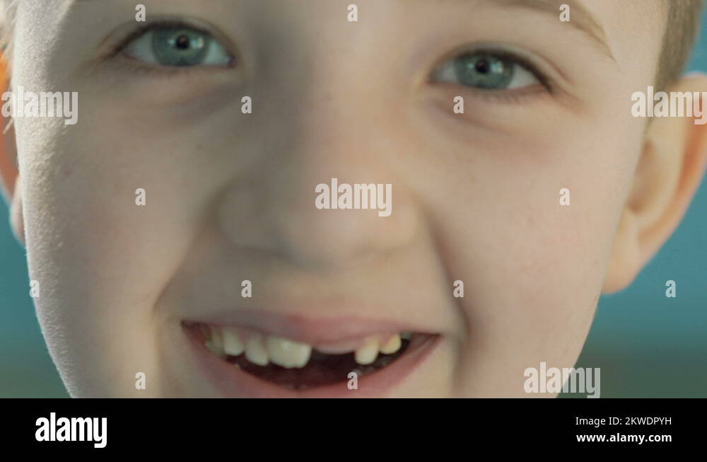 Toothless boy Stock Videos & Footage - HD and 4K Video Clips - Alamy