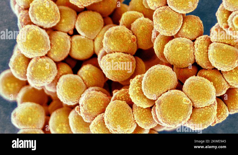 Staphylococcus aureus sem Stock Videos & Footage - HD and 4K Video ...