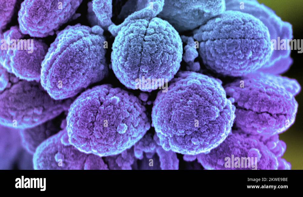 Streptococcus micrograph Stock Videos & Footage - HD and 4K Video Clips - Alamy