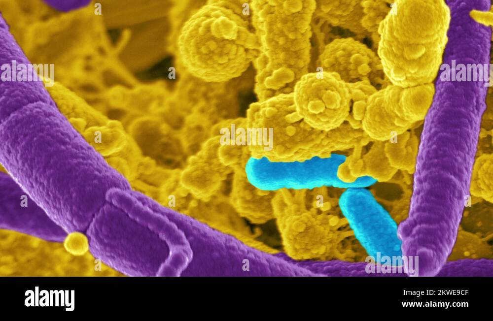 Filamentous bacteria Stock Videos & Footage - HD and 4K Video Clips - Alamy