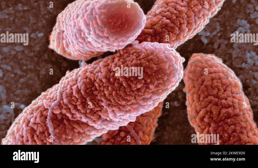 Escherichia coli micrograph Stock Videos & Footage - HD and 4K Video Clips - Alamy
