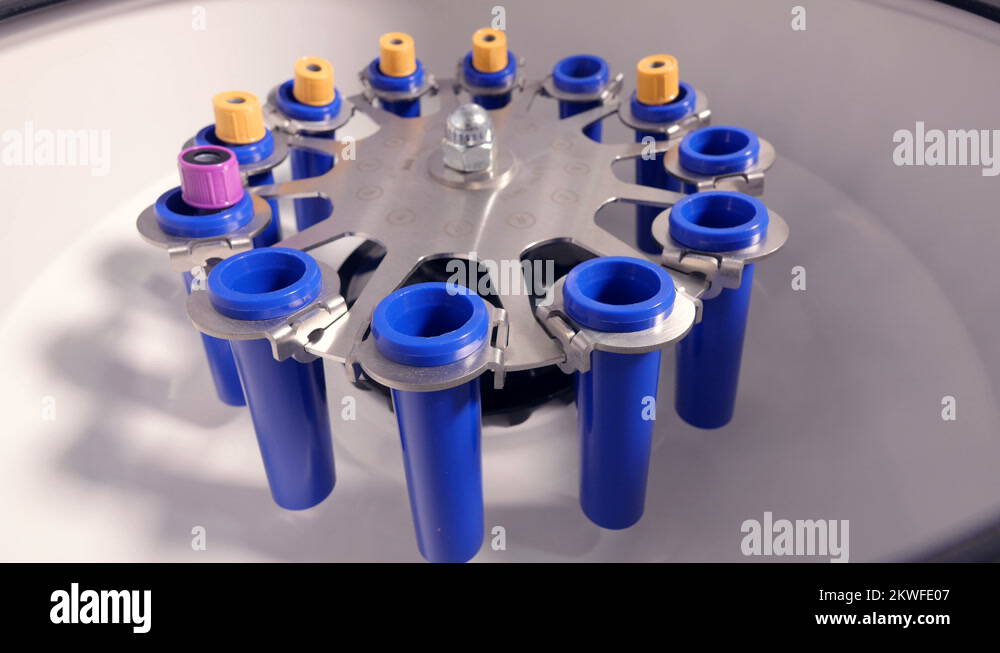 Vial blood samples test Stock Videos & Footage - HD and 4K Video Clips ...