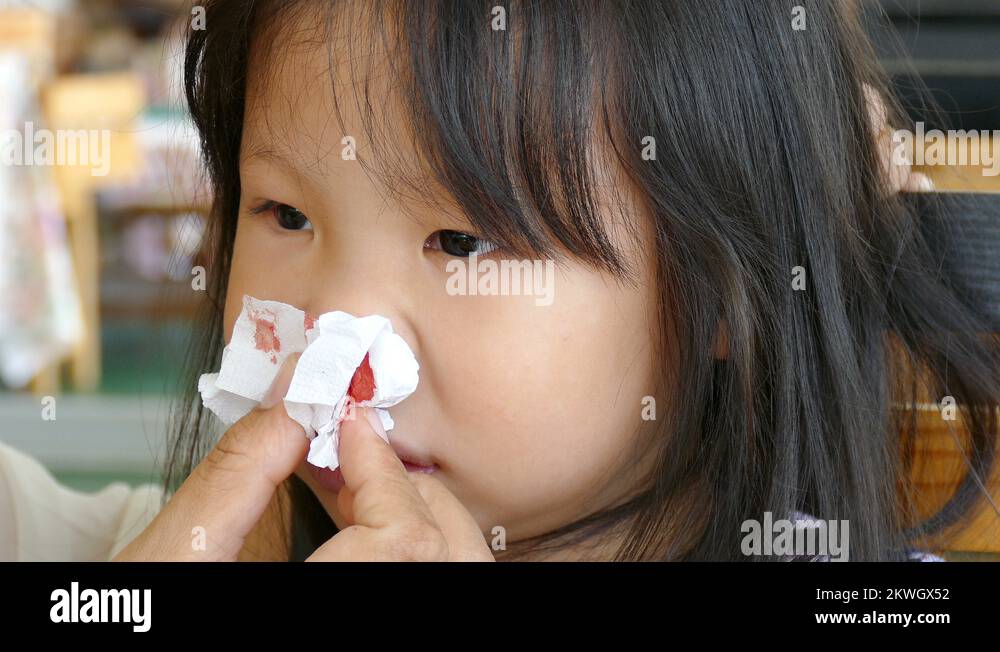Wipe nose with hand Stock Videos & Footage - HD and 4K Video Clips - Alamy