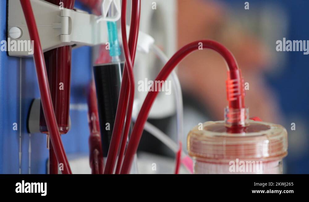 Dialyser Stock Videos & Footage - HD and 4K Video Clips - Alamy