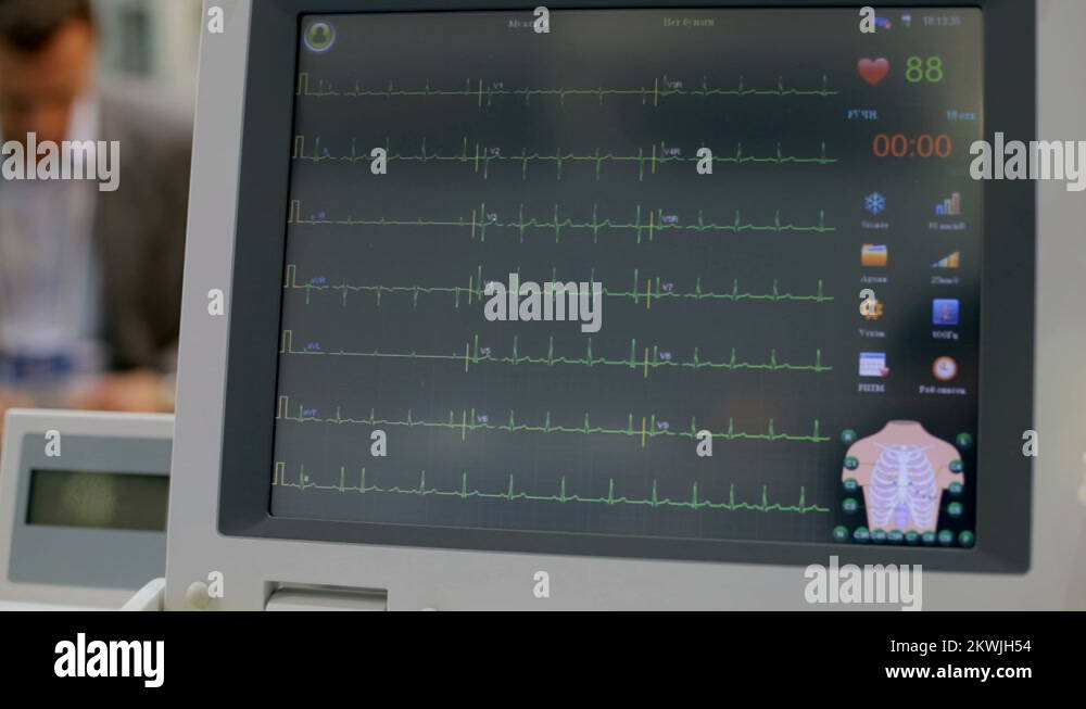 Mechanical diagram Stock Videos & Footage - HD and 4K Video Clips - Alamy