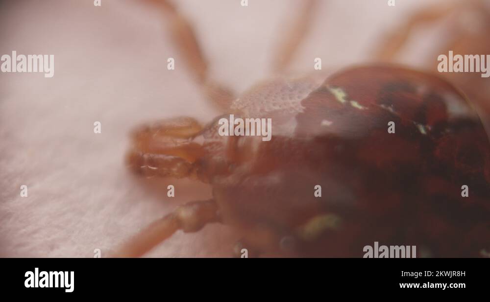 Tick head Stock Videos & Footage - HD and 4K Video Clips - Alamy