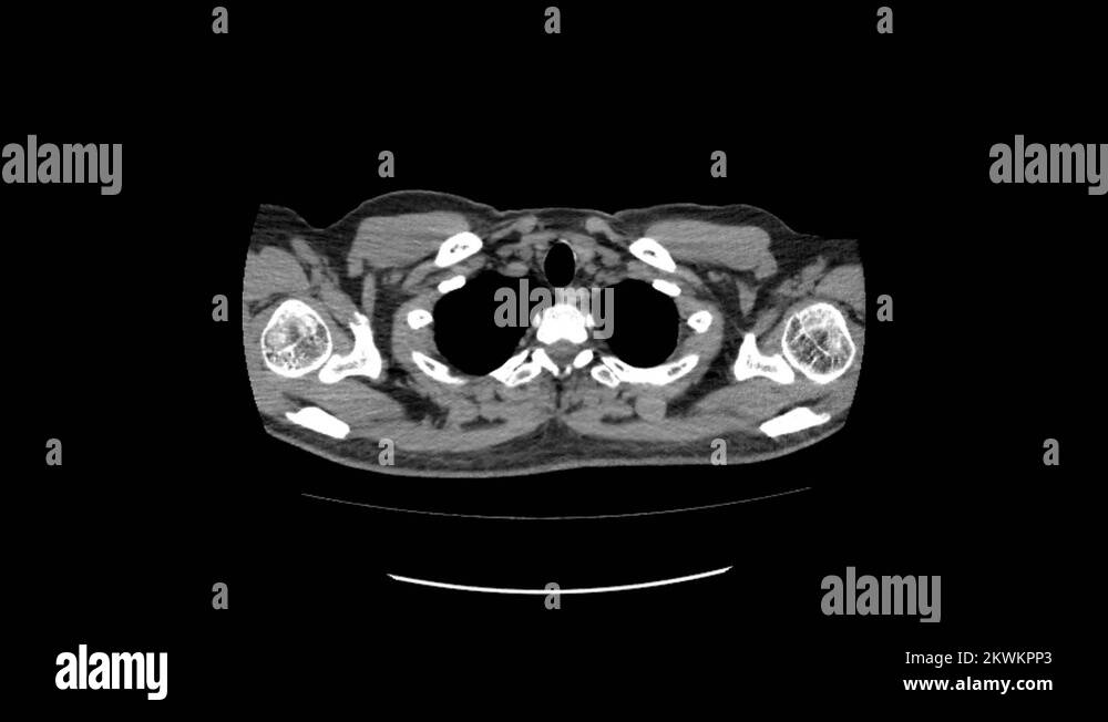 Mri upper abdomen Stock Videos & Footage - HD and 4K Video Clips - Alamy