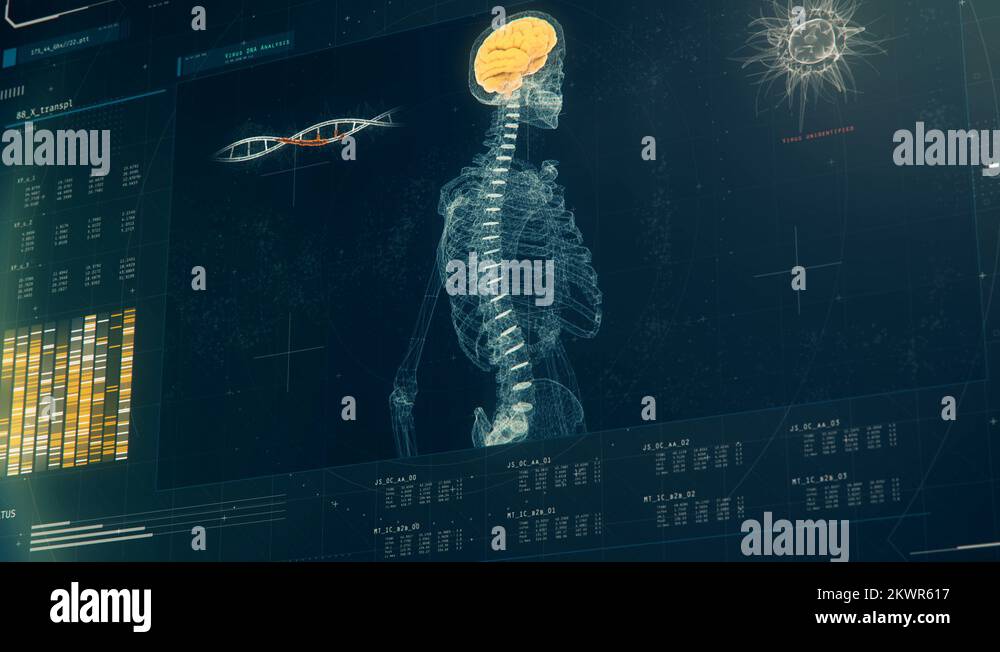 Patient's brain scan results on screen, DNA mutation, virus detection ...