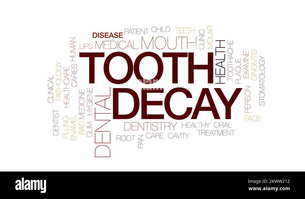 Tooth decay animated word cloud, text design animation. Kinetic ...