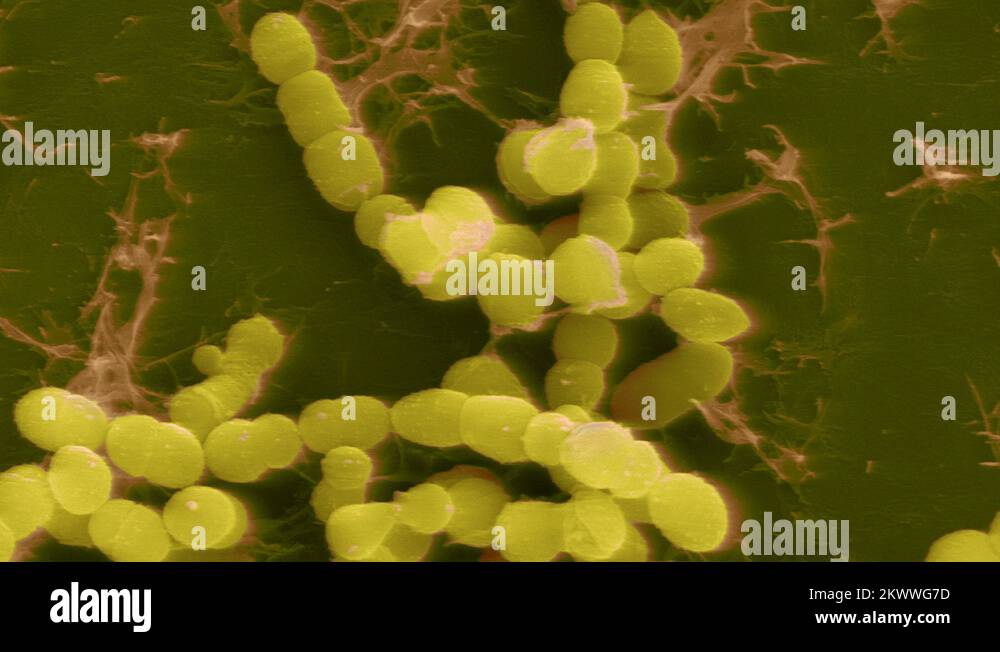 Anaerobic streptococcus Stock Videos & Footage - HD and 4K Video Clips ...