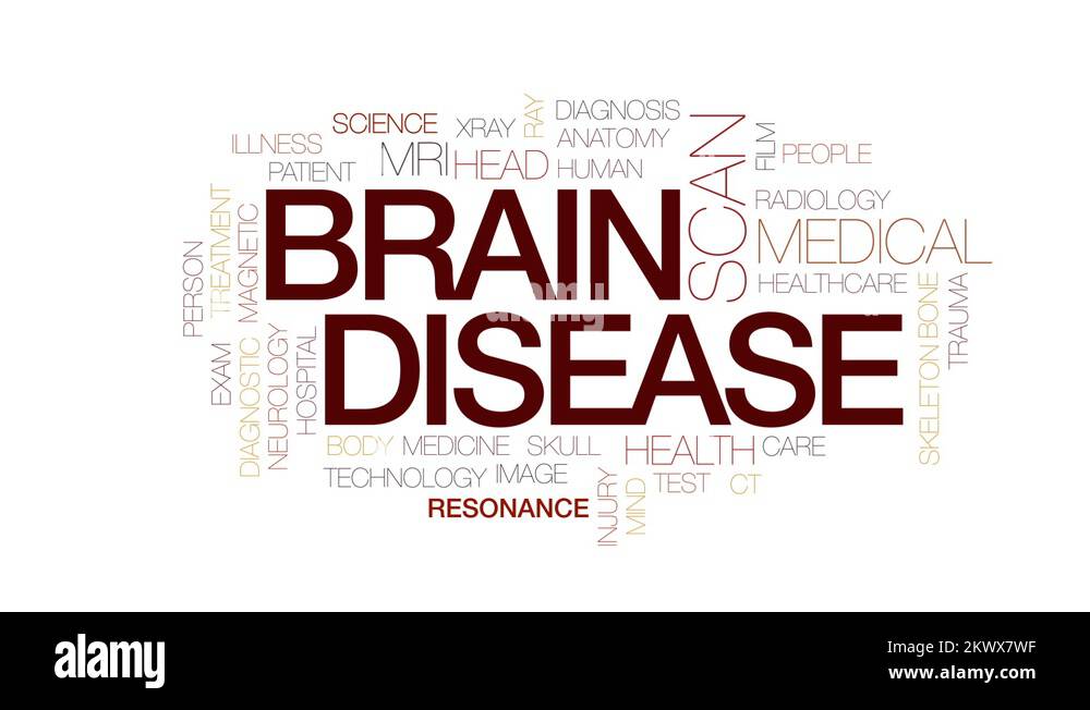 Brain disease animated word cloud, text design animation. Kinetic ...