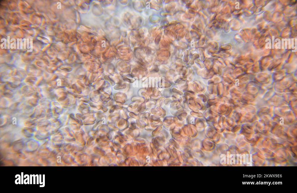 Flowing Red Blood Cells under Microscope - high magnification Stock ...