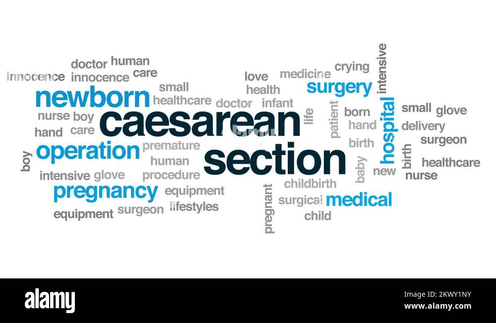 Caesarean section animated word cloud, text design animation Stock ...