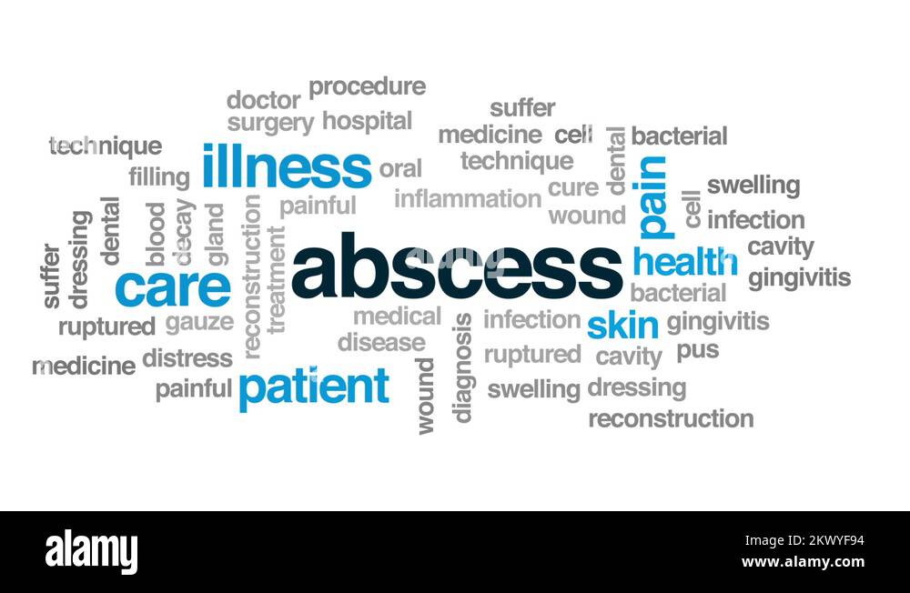 Pus abscess Stock Videos & Footage - HD and 4K Video Clips - Alamy