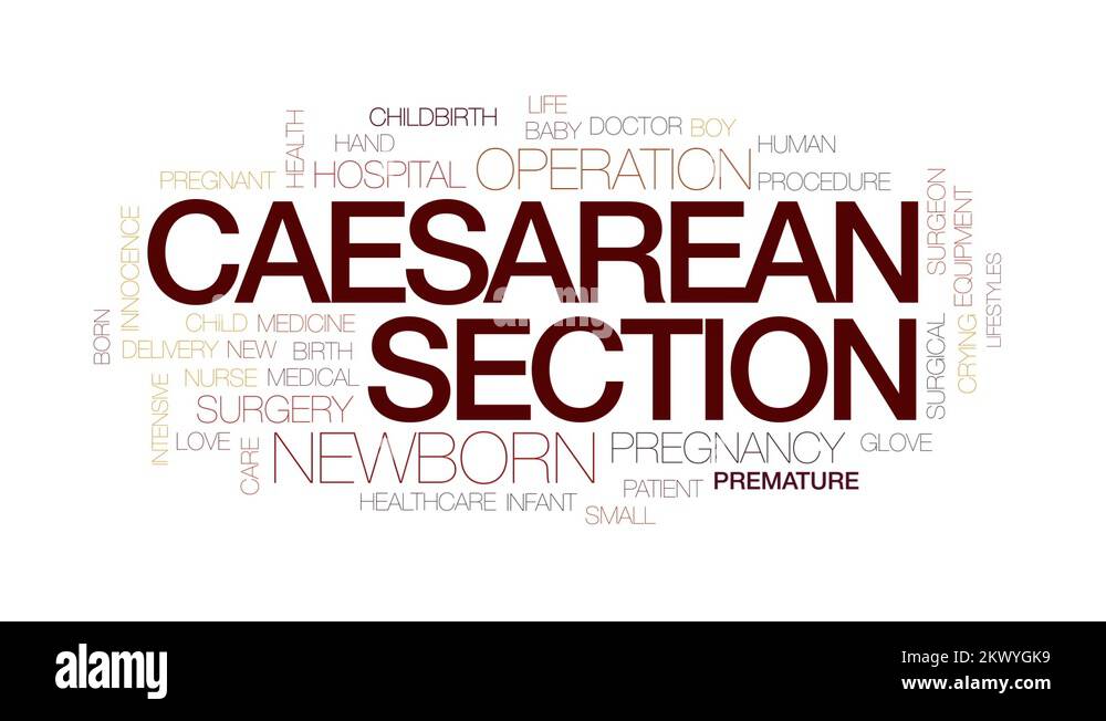 Caesarean section animated word cloud, text design animation. Kinetic ...