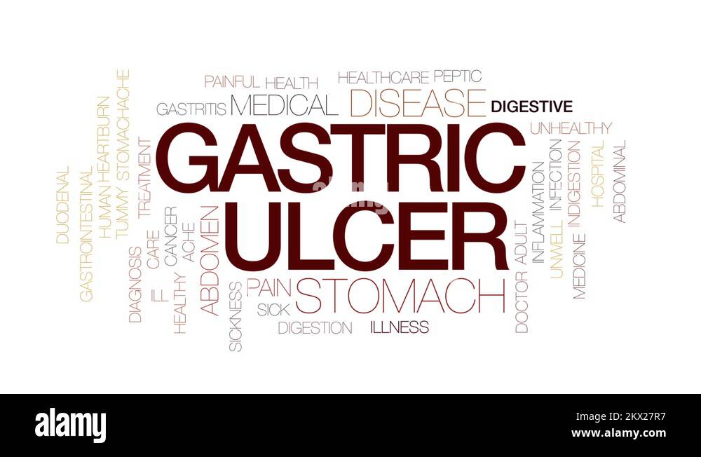 Gastric ulcer animated word cloud, text design animation. Kinetic ...