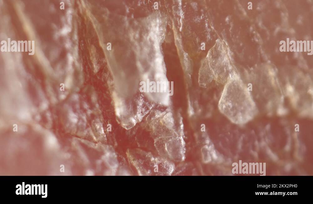 Skin crust Stock Videos & Footage - HD and 4K Video Clips - Alamy