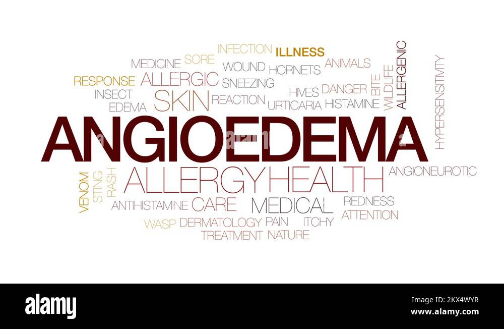 Angioedema animated word cloud, text design animation. Kinetic ...