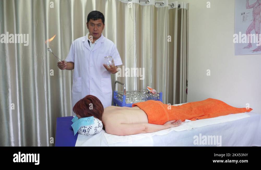 Fire Cupping Therapy Stock Videos And Footage Hd And 4k Video Clips Alamy