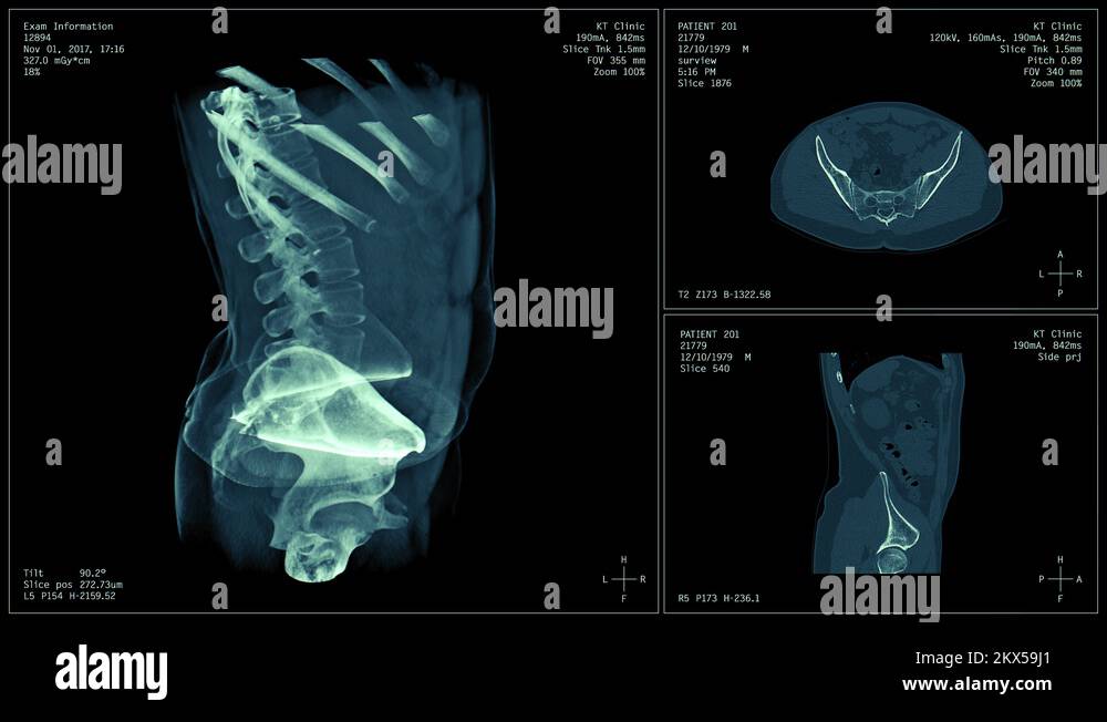 Body CT scan image, radiography x-ray examination, MRI tomography Stock ...