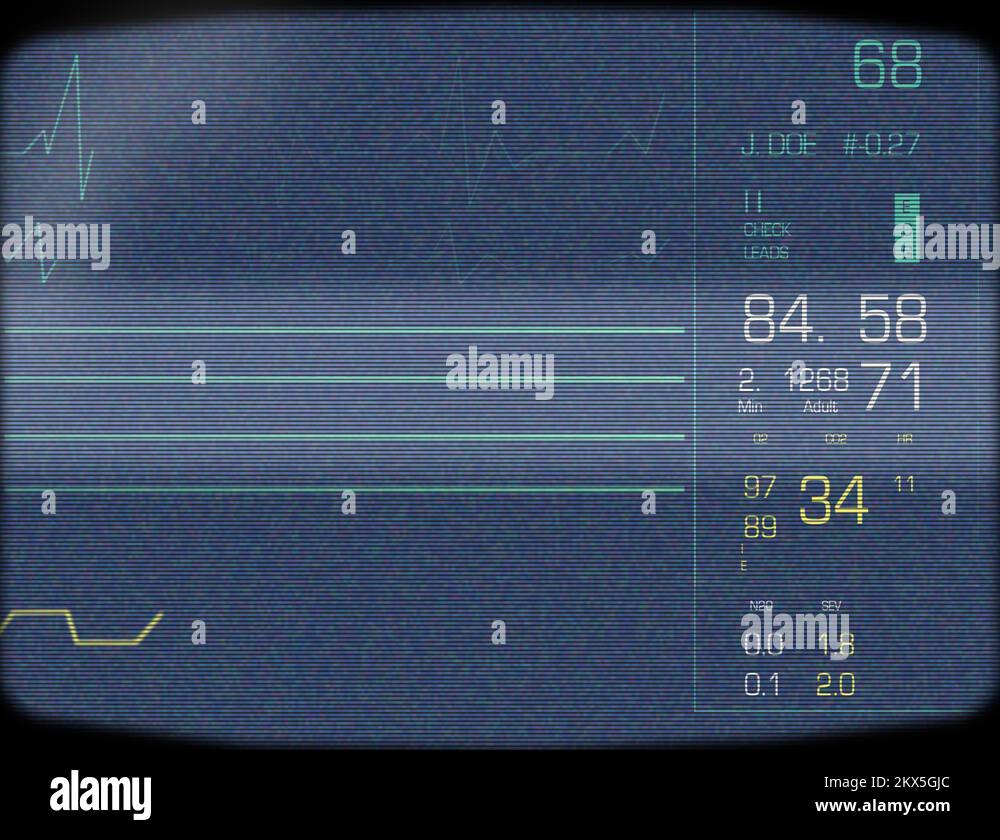 Heart monitor screen Stock Videos & Footage - HD and 4K Video Clips - Alamy