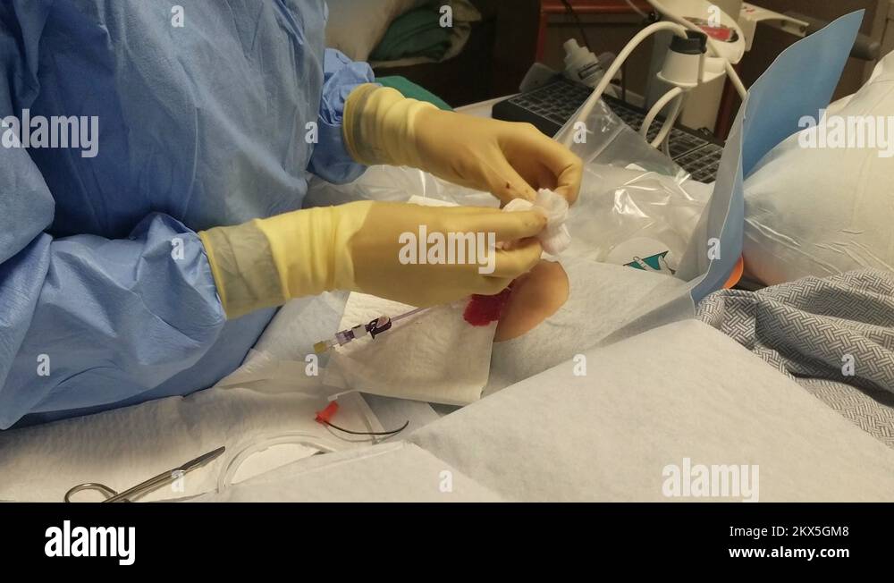 Hospital surgery procedure cancer patient PICC infusion 4K Stock Video ...