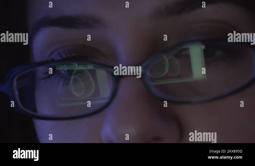 Mri scan head Stock Videos & Footage - HD and 4K Video Clips - Alamy