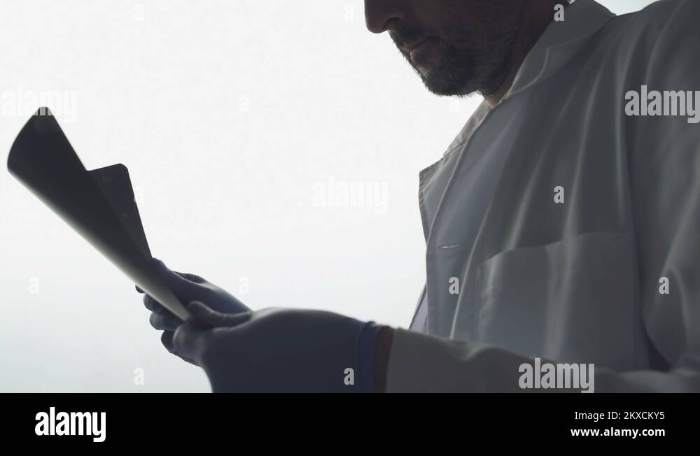 Doctor skull fracture xray Stock Videos & Footage - HD and 4K Video ...