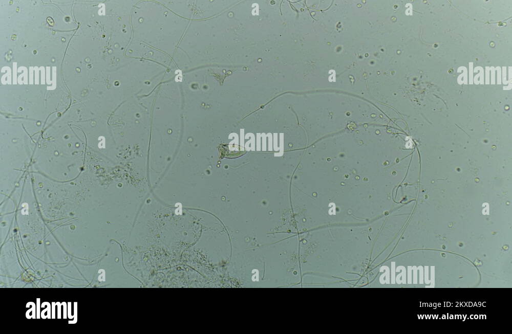 transparent microorganism under the microscope, with internal organs ...