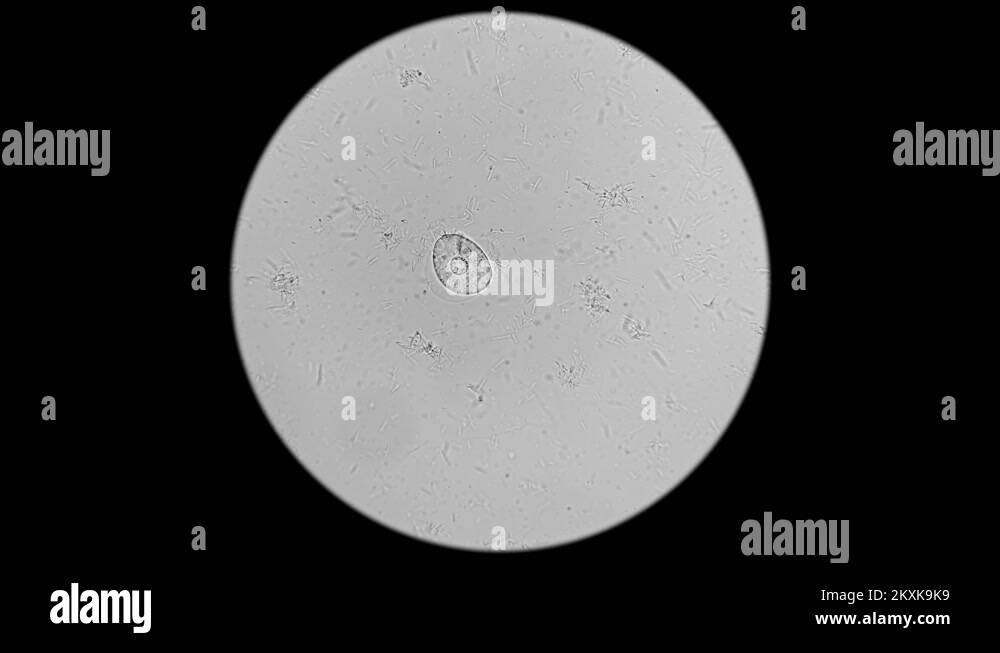 colony of bacteria-cadaveric fingers under the microscope Stock Video ...