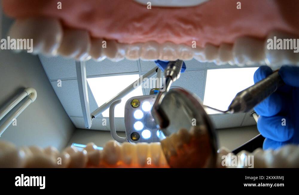 Dentist doing a checkup on teeth from inside mouth angle Stock Video ...
