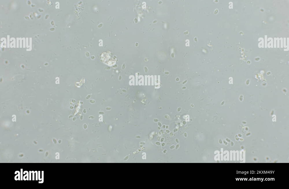 a large colony of protozoa moves under a microscope Stock Video Footage ...