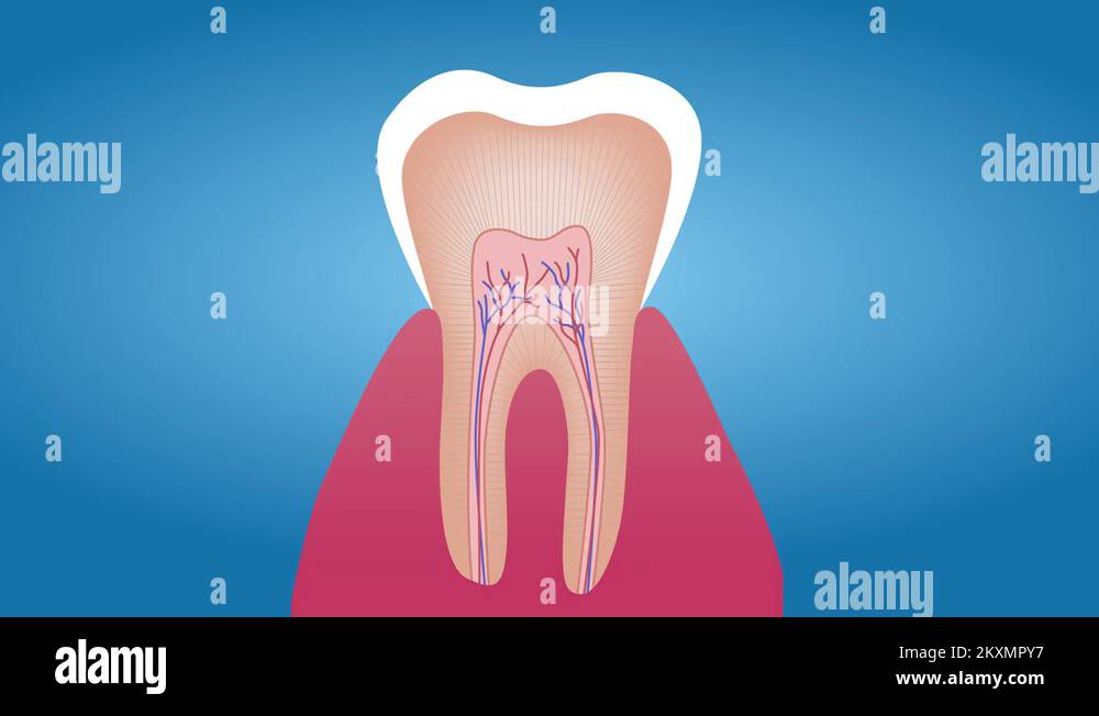 Anatomy tooth caries Stock Videos & Footage - HD and 4K Video Clips - Alamy