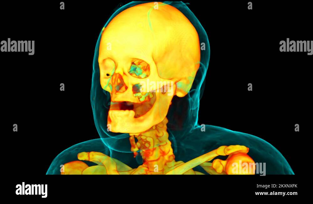 Female Head Anatomy Stock Video Footage - Alamy