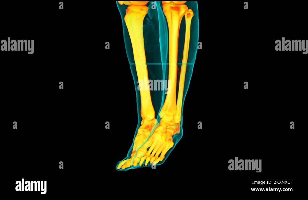 Lower body anatomy Stock Videos & Footage - HD and 4K Video Clips - Alamy