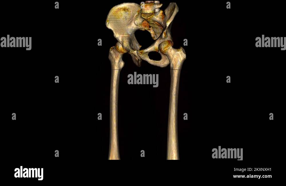 Male pelvis anatomy Stock Videos & Footage - HD and 4K Video Clips - Alamy