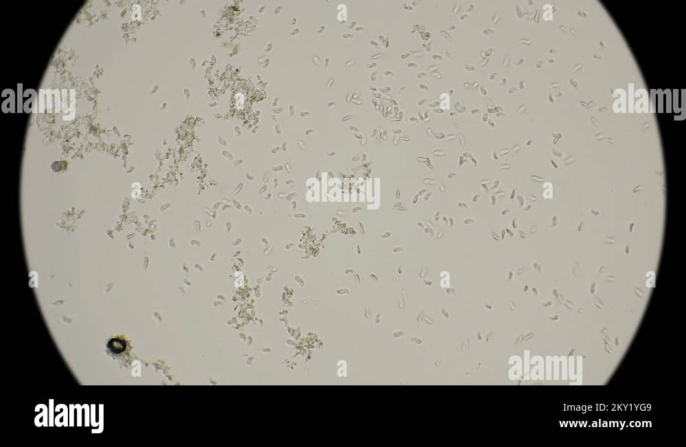 a large colony of protozoa moves under a microscope Stock Video Footage ...