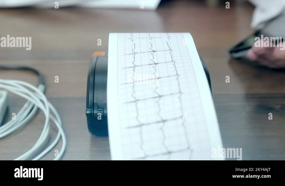 Doctor prints on the ECG ECG printer close-up Stock Video Footage - Alamy