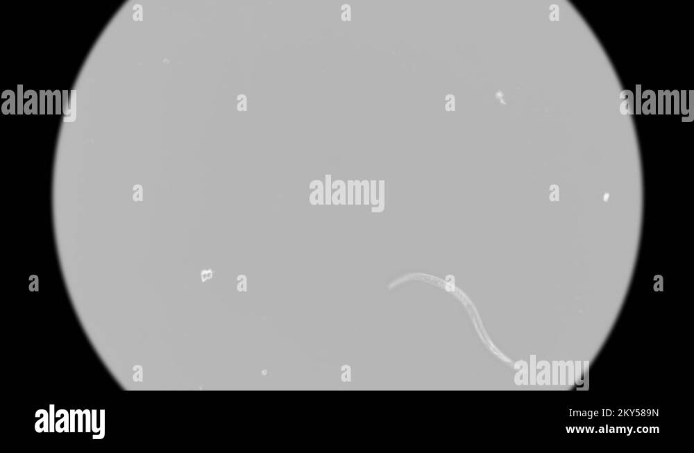 the nematode worm under a microscope Stock Video Footage - Alamy
