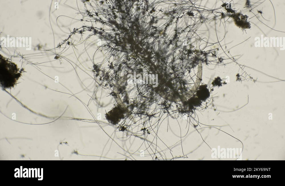 Nematode worm Stock Videos & Footage - HD and 4K Video Clips - Alamy